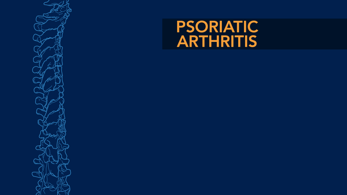 Psoriatic Arthritis - Spondylitis of The Spine - The Spine Community